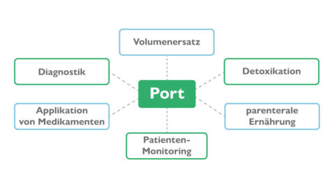 Portkatheter und Portkanülen - Vygon