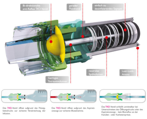 6 SCHLÜSSELASPEKTE ZUR RICHTIGEN HANDHABUNG UND PFLEGE EINES ZVK - Vygon